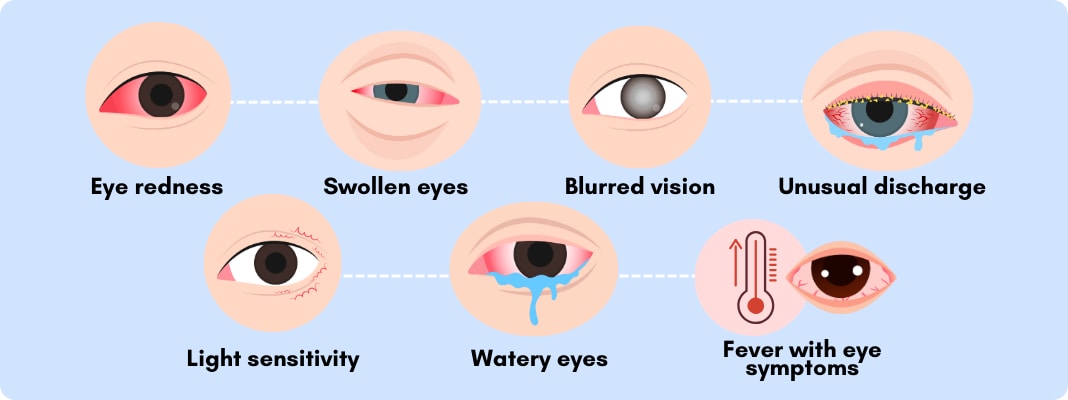 Eye Boogers: What They Are and When to Worry | 1-800-GET-LENS